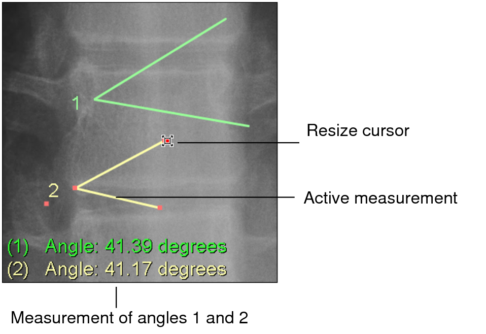 Measuring Simple Angles