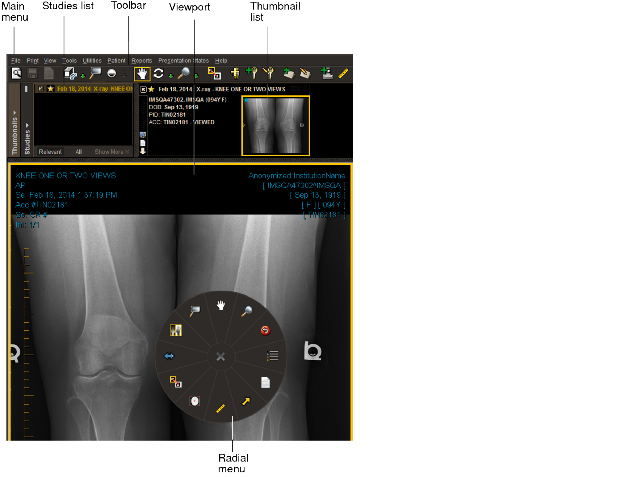 Understanding the InteleViewer Interface