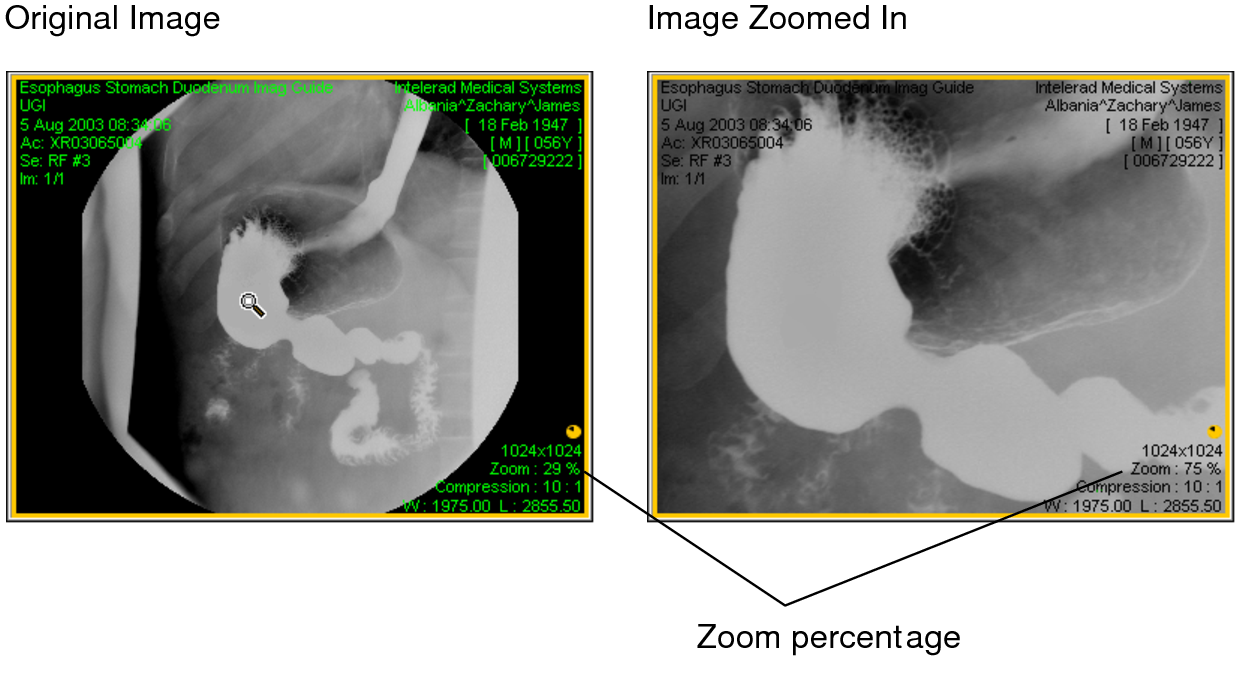 Zooming Images