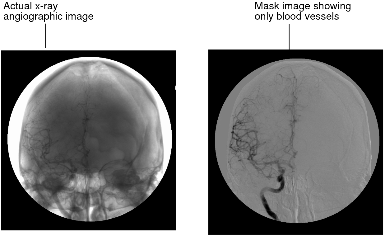 Reading Images by using DSA