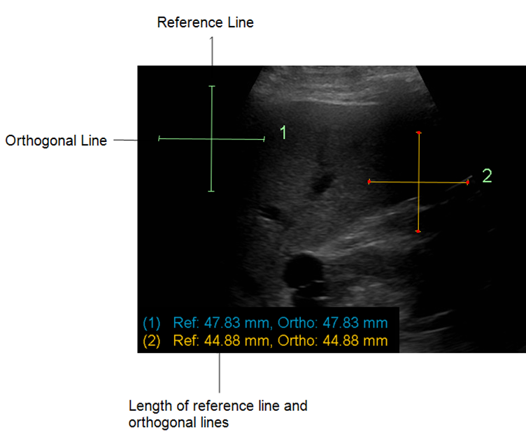 Measuring Orthogonal Lines