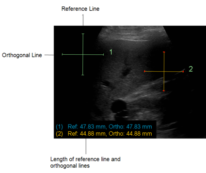 Measuring Orthogonal Lines