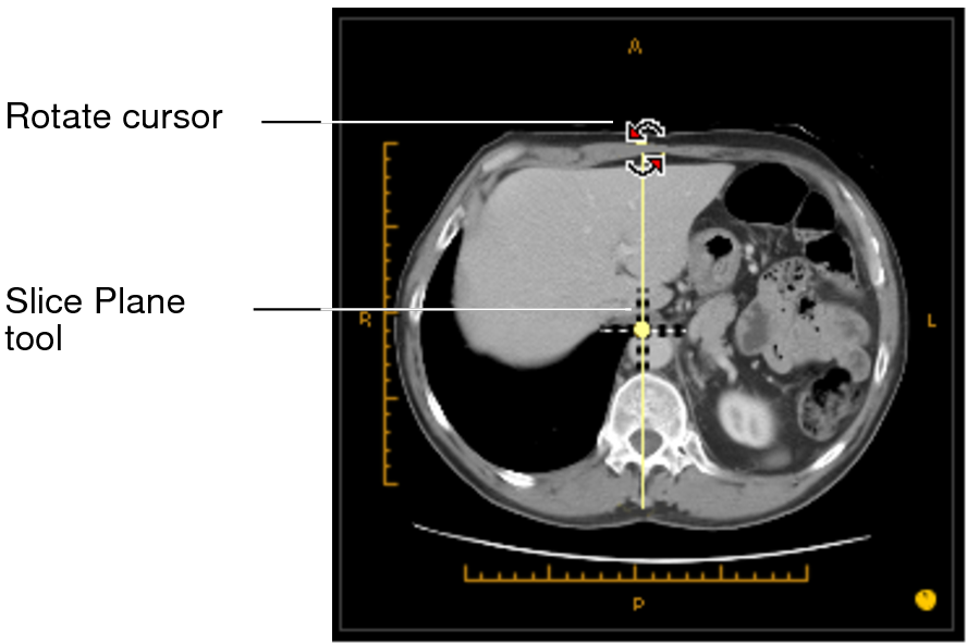 Viewing Orthogonal Multi-Planar Reformats