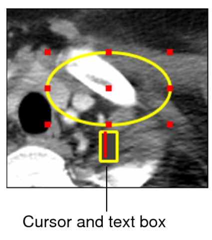 Creating Ellipse Annotations