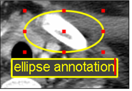 Creating Ellipse Annotations