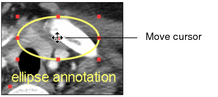 Creating Ellipse Annotations