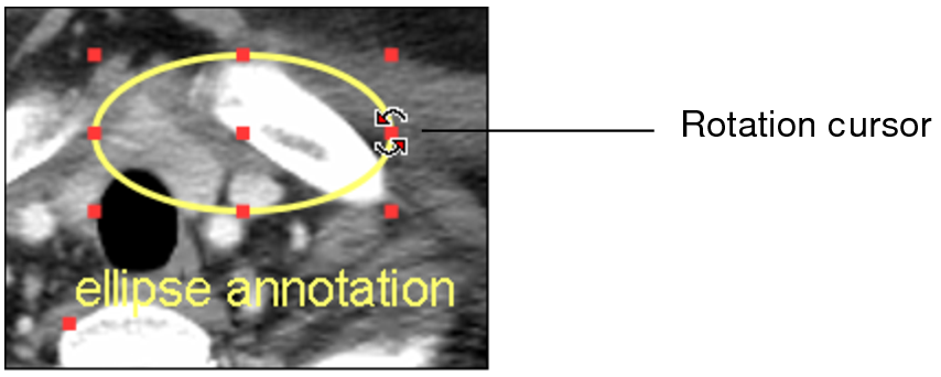 Creating Ellipse Annotations