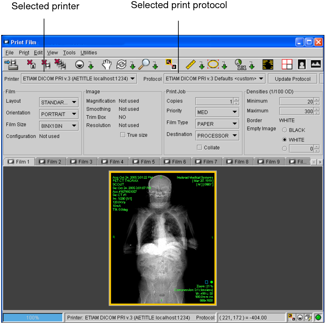 Creating Print Protocols