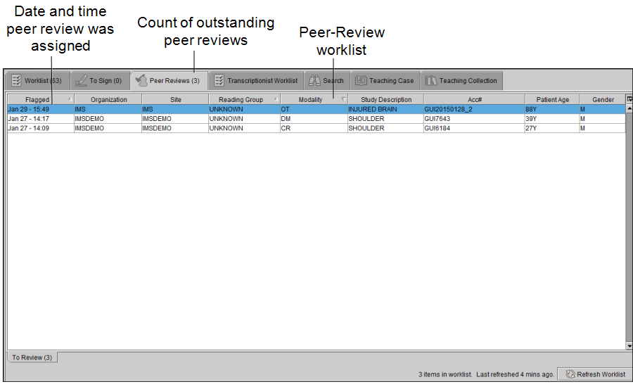 Understanding the Peer Review Worklist