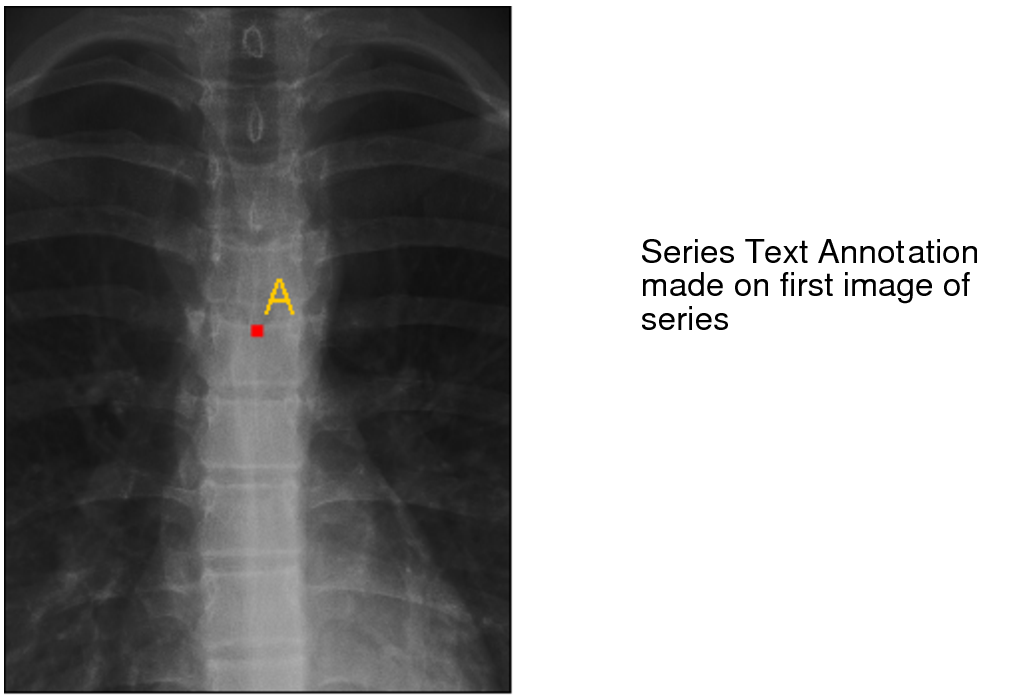 Creating Text Annotations