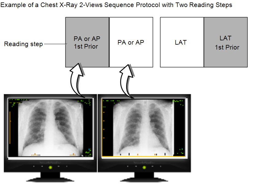 Understanding Reading Steps and Views