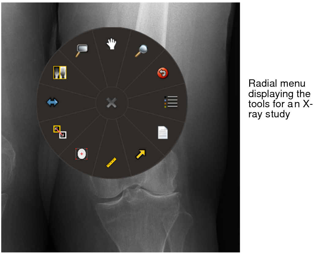 Displaying the Radial Menu