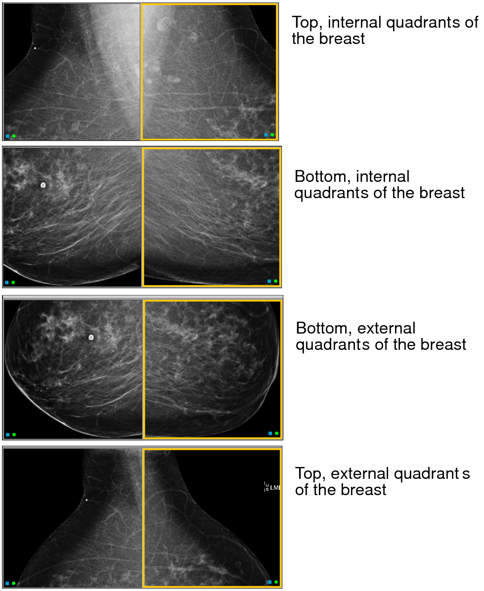 Viewing Magnified Sections