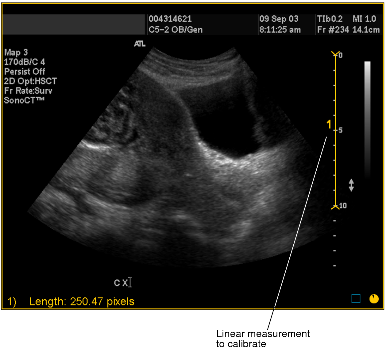 Calibrating and Recalibrating Measurements