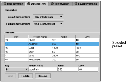 Creating Window Level Presets