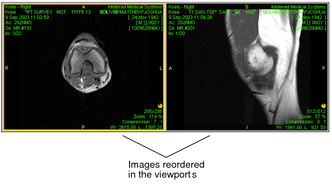 Reordering Series in the Viewports