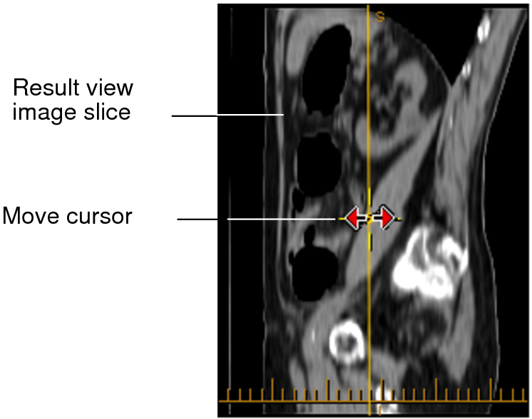 Viewing Orthogonal Multi-Planar Reformats