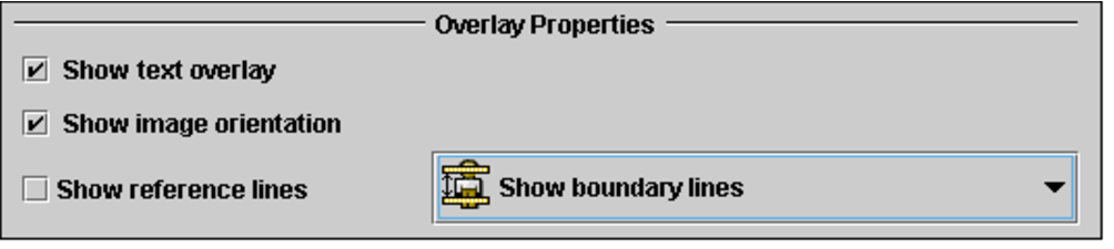 Customizing Overlay Preferences