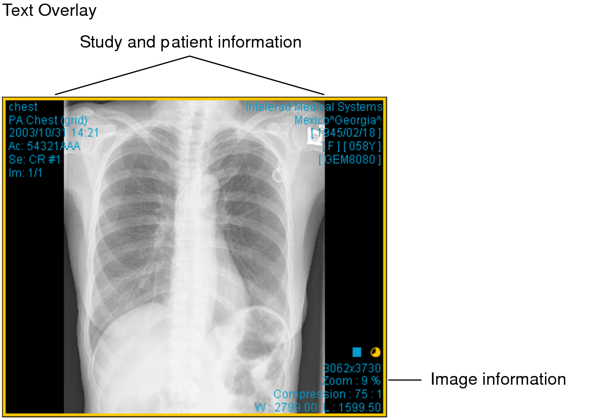 Customizing Overlay Preferences