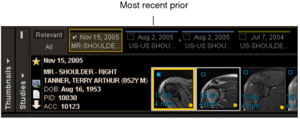 Interpreting Color in the Studies List and Thumbnail strip