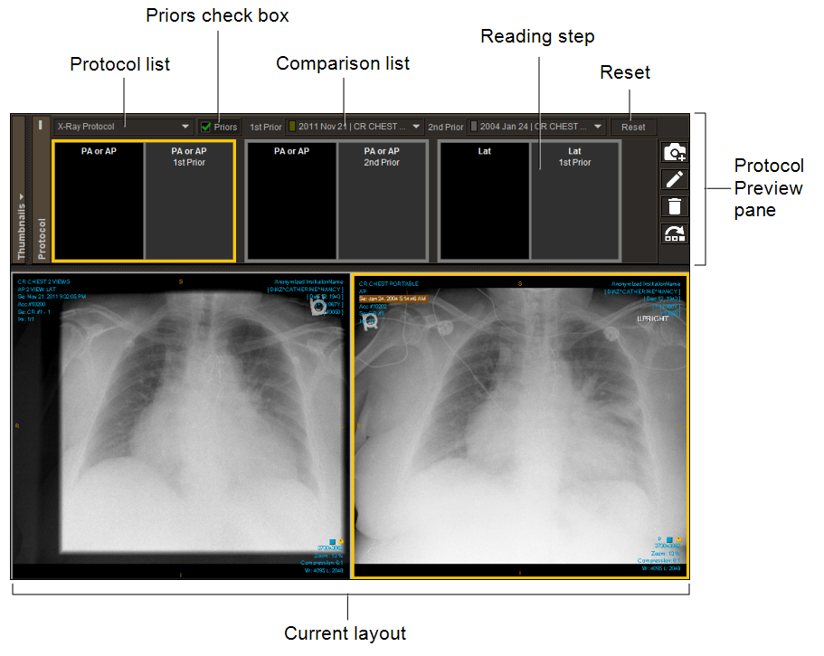 Understanding the Protocol Preview