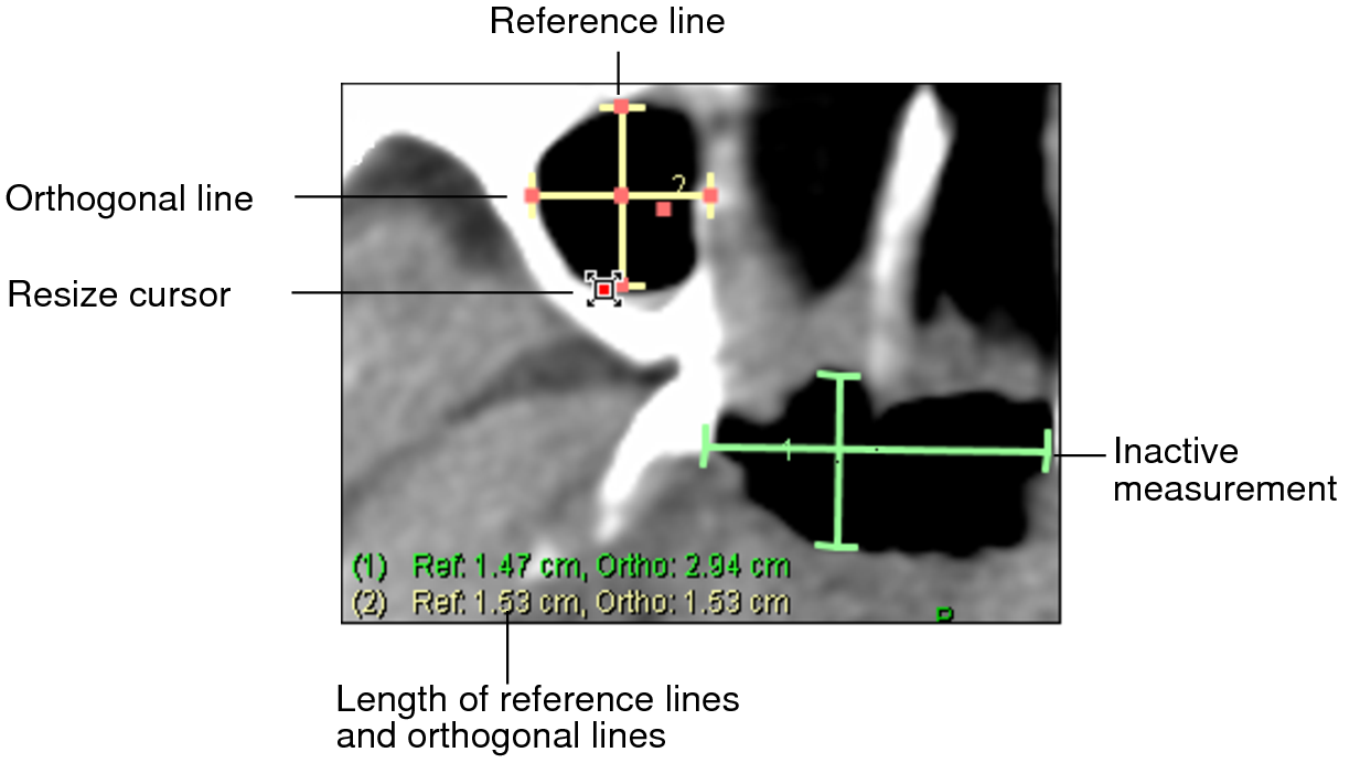 Measuring Orthogonal Lines