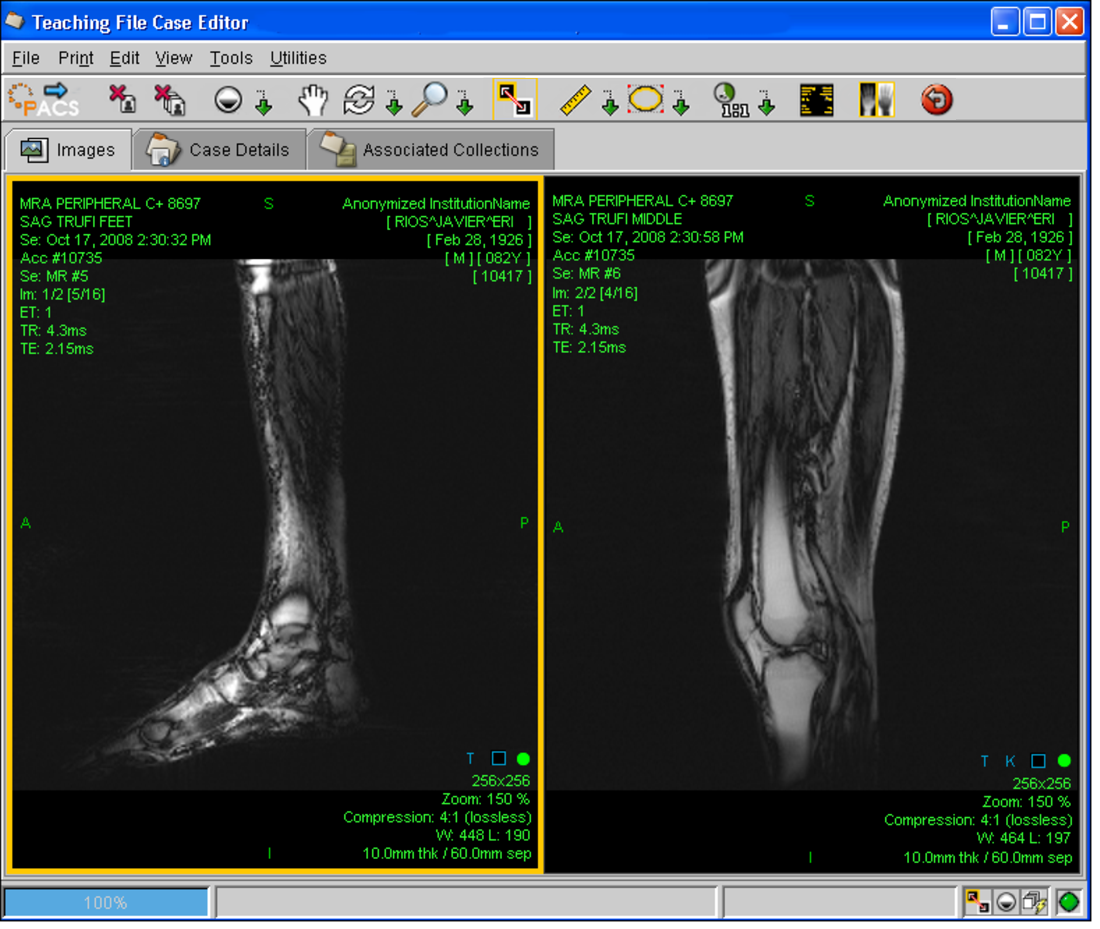 Adding and Removing Images from Teaching Cases