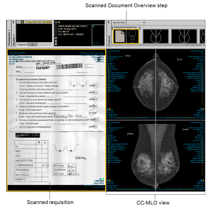 Displaying Scanned Documents in Mammography Studies