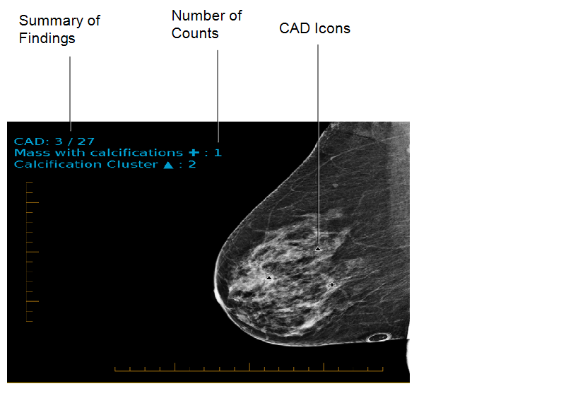 Displaying Genius AI CAD on 2D Images