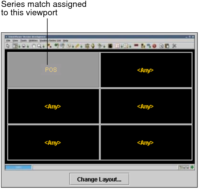 Assigning Series Matches to Viewports
